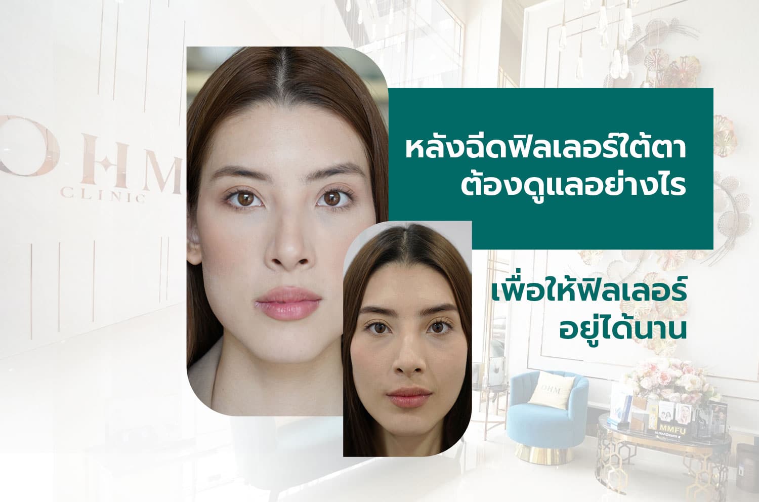 วิธีดูแลดวงตา หลังฉัดฟิลเลอร์ใต้ตา | OHM Clinic